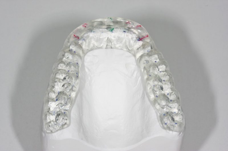 Schienen, KFO- und FKO-Geräte | Dentallabor Horn