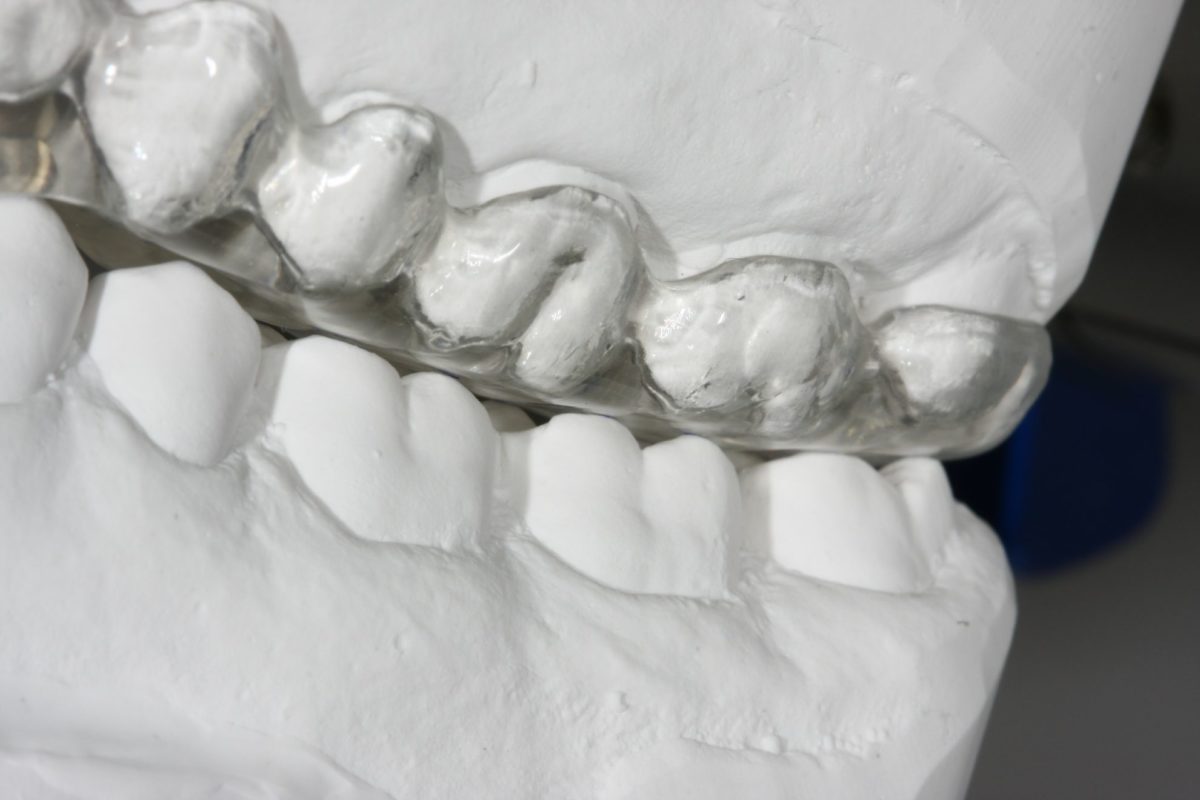 Schienen, KFO- und FKO-Geräte | Dentallabor Horn